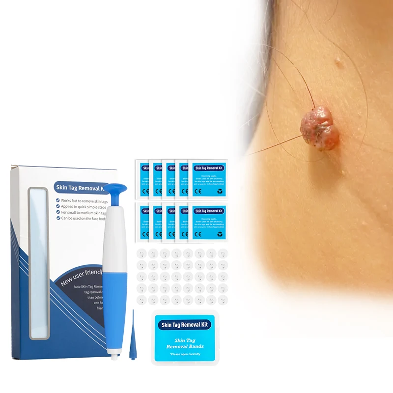 2-In1-Painless-Auto-Skin-Tag-Mole-Wart-Removal-Kit-Cleaning-Tools-Face ...