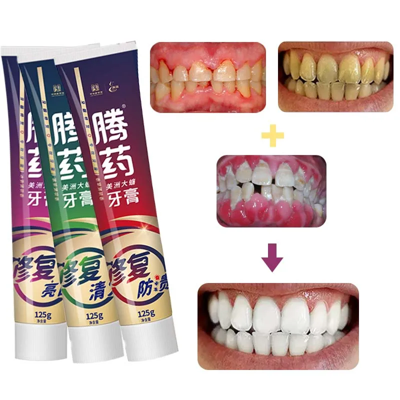 Removal-Plaque-Tooth-Whitening-Strips-Toothpaste-Fresh-Breath-Mouth ...