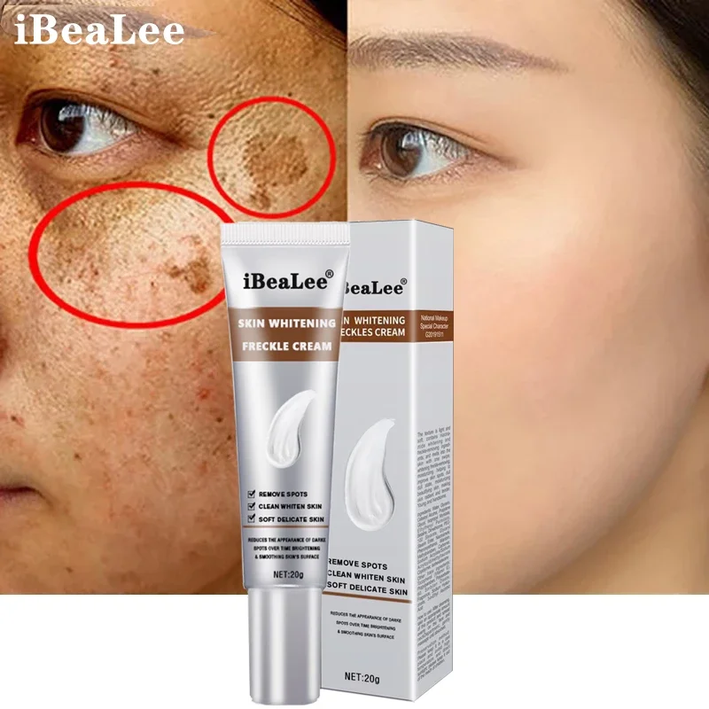 Ibealee 미백 주근깨 크림 기미 제거 크림 다크 스팟 제거 멜라닌 기미 제거제 브라이트닝 피부 안티에이징