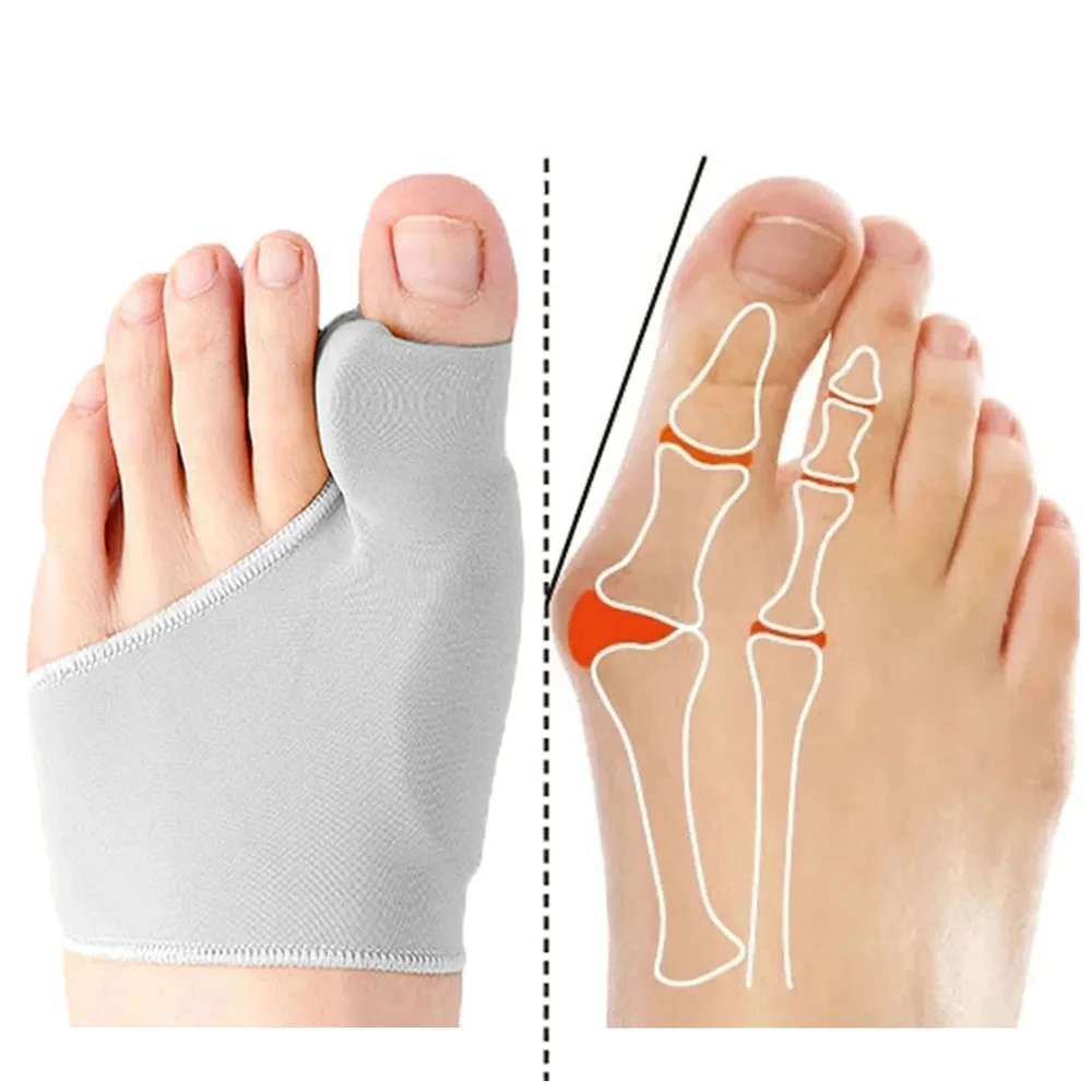 2pcs=1pair Men's Socks Gray Toe Hallux Valgus Bunion Corrector ...