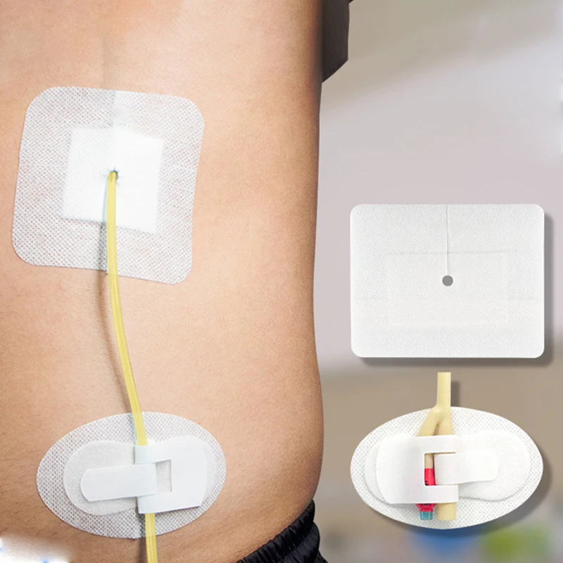 5Pcs Drainage Tube Sterile Applicator Peritoneal Dialysis Catheter Bile ...
