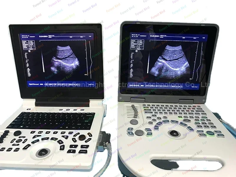 than-logiq-ultrasound-2D-machine-Cheap-Ecograph-Laptop-Black-and-White ...