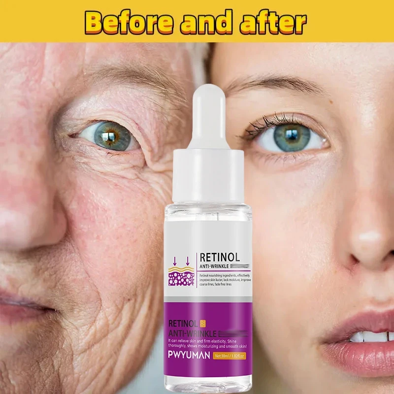 Suero-Facial-para-eliminaci-n-de-arrugas-Retinol-regeneraci-n-de-col-geno-antienvejecimiento ...