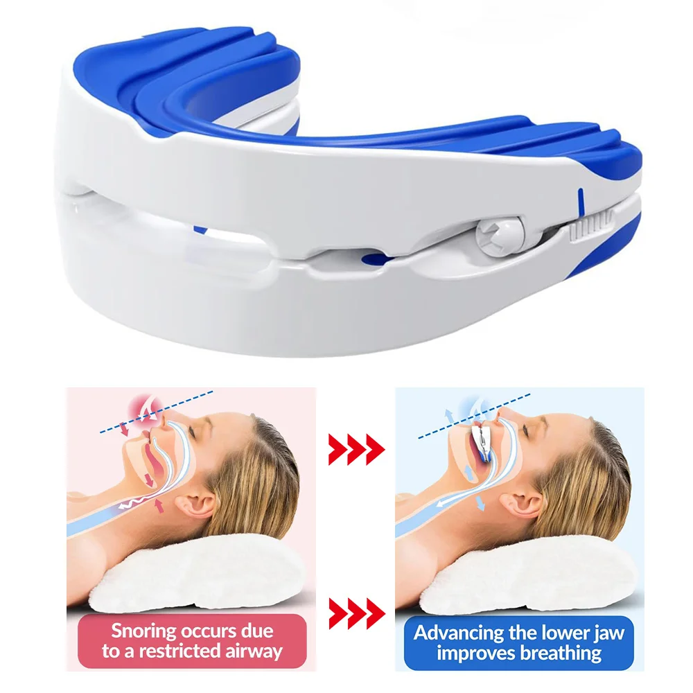 Adjustable Anti-Snoring Mouth Guard, Anti-Snoring Device, Prevents ...