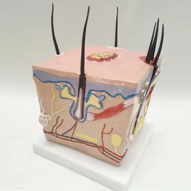 Scalp Model Hair Loss Hair Transplant Hair Follicle Inflammation ...