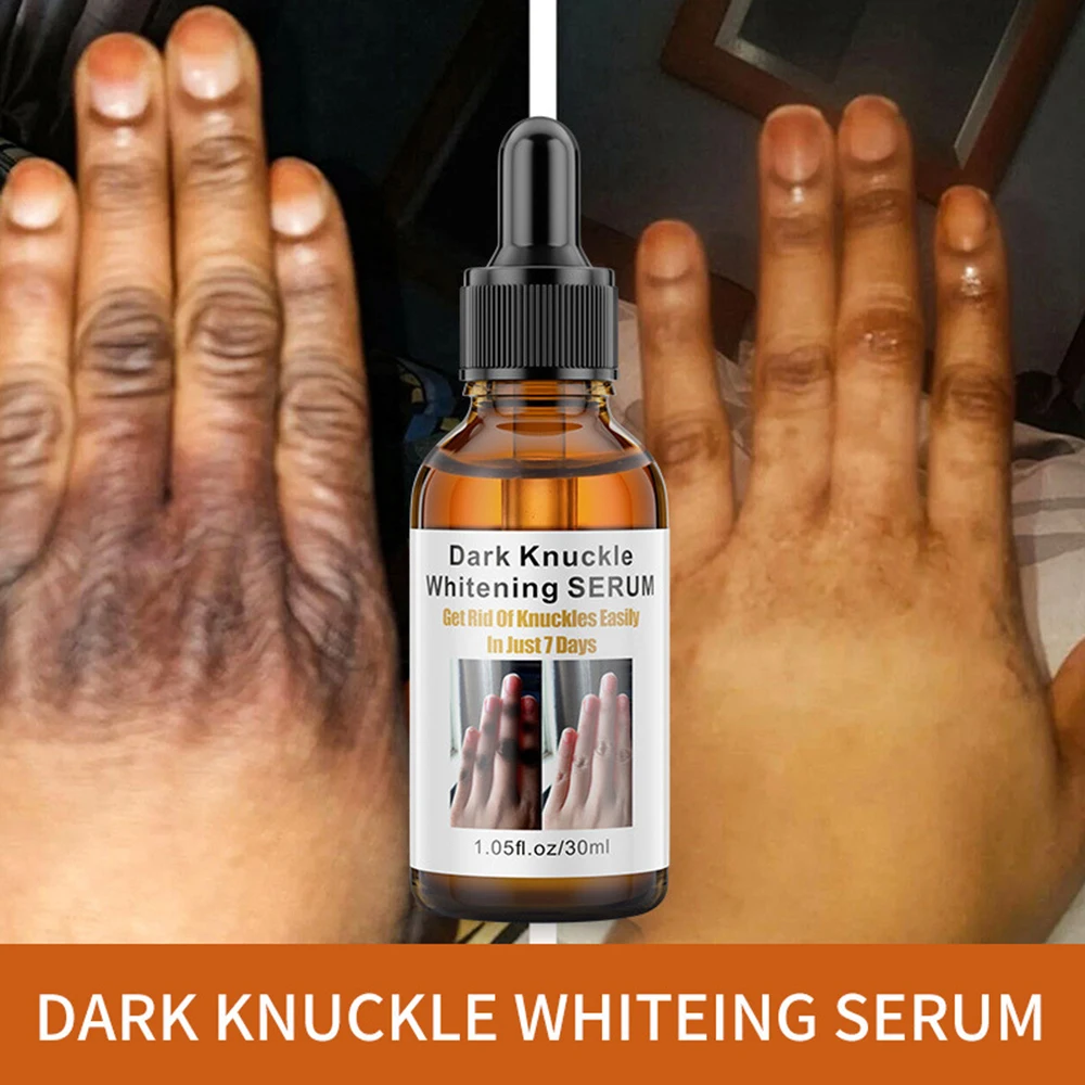 Dark Knuckles Fast Whitening Serum Pigmentation Correctors for Black ...