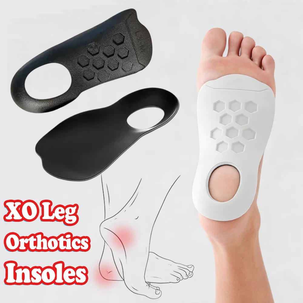 Orthotic Insoles for Flat Feet XO Legs High Support Arch Pads Anti ...