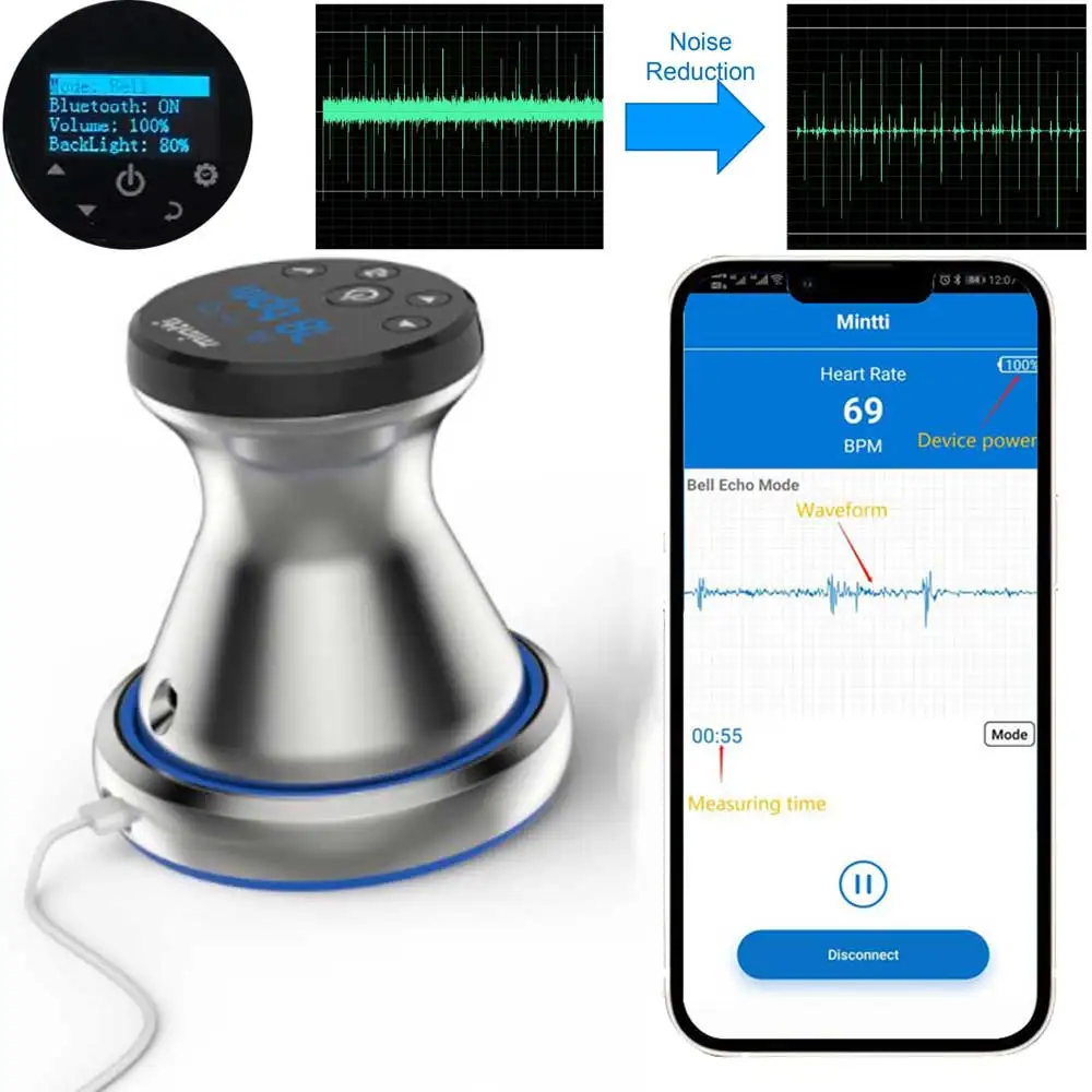 Bluetooth-Charge-Digital-Stethoscope-Wireless-Stethoscope-100x-Audio ...