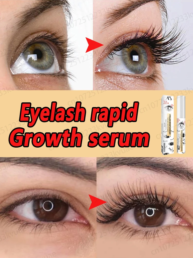 Rapid-Eyelash-Growth-Serum-Grows-Eyelashes-and-Increases-Eyelash-Thickness.jpg