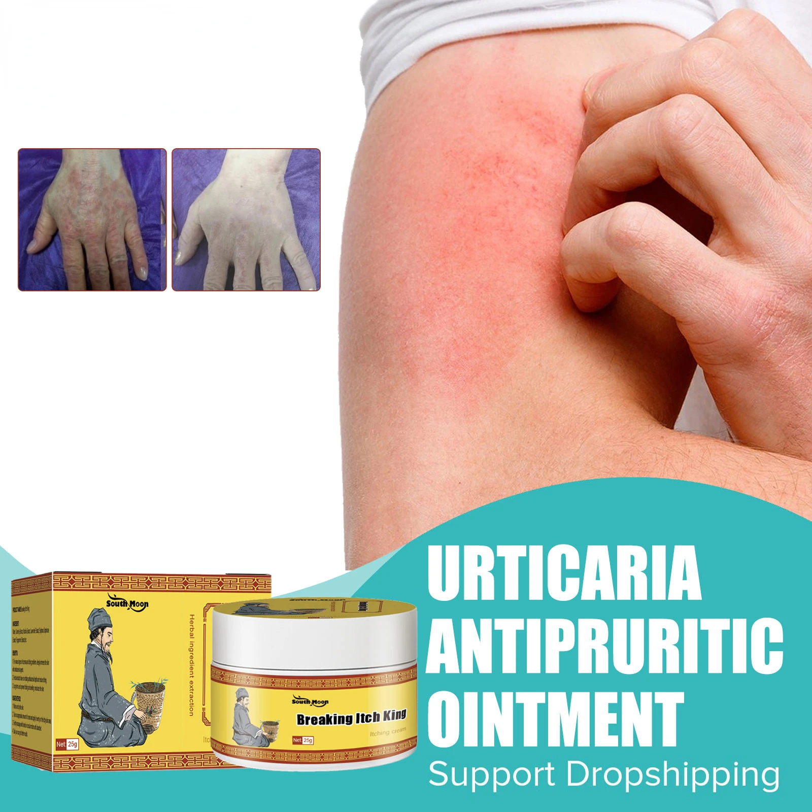 Eczematoid-Eczema-Ointment-Inhibit-Dermatitis-Urticaria-Hand-Tinea ...