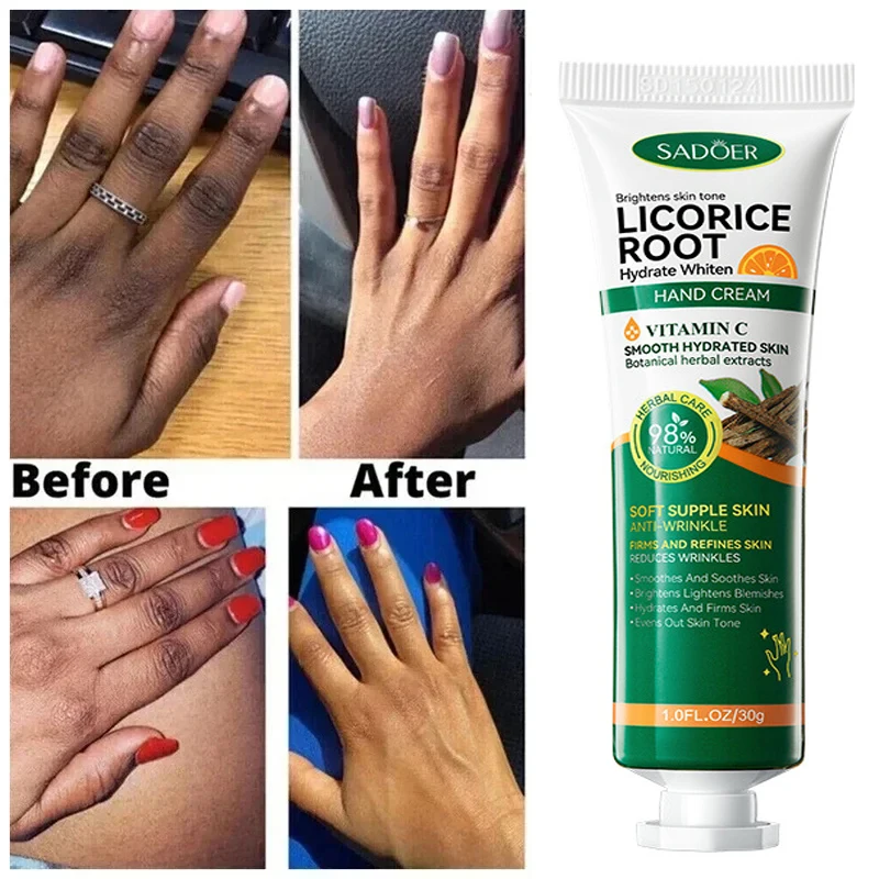 Fast-Whitening-Dark-Knuckles-Brighten-Hand-Cream-Melanin-Corrector ...