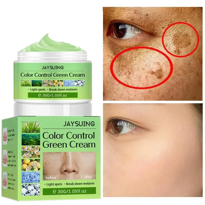 Whitening-Freckles-Cream-Face-Remove-Melasma-Dark-Spots-Lighten-Melanin ...