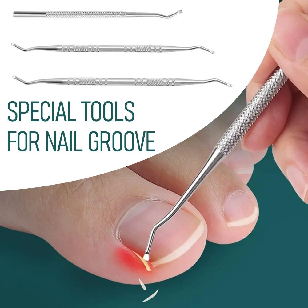 Ingrown Toenail Tool Kit – Hawkbill Pliers with Ingrown Nail Lifter ...