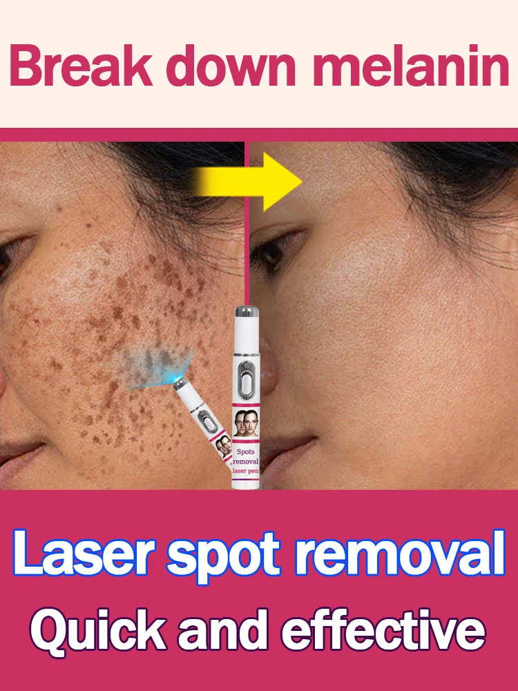 Facial-spots-disappear.jpg