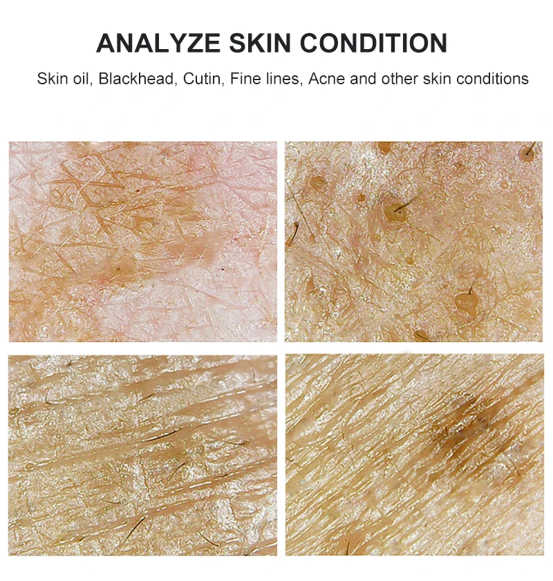 Skin Analyzer 7 inch 50X/200X Magnifying Scepter Analyzer 500W HD Skin ...