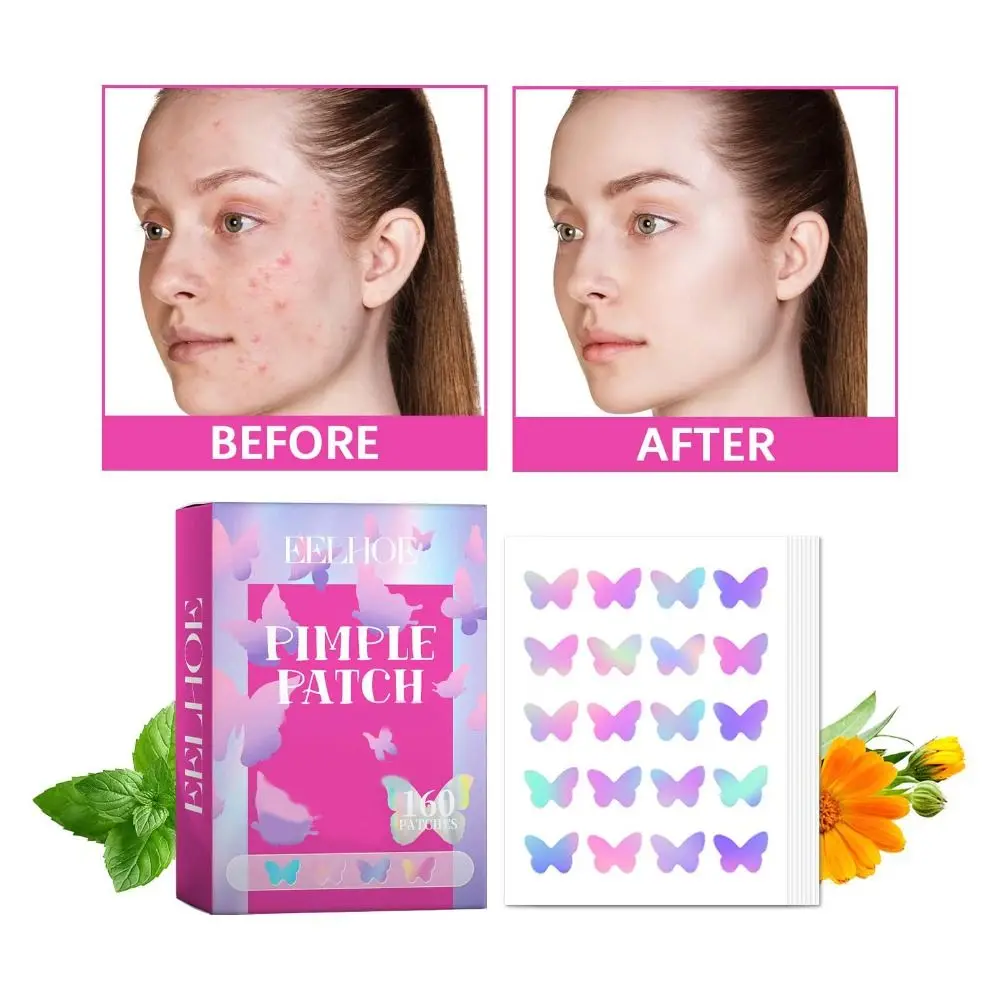 Butterfly-Shape-Acne-Pimple-Patch-Pimple-Remover-Treatment-Acne-Acne ...
