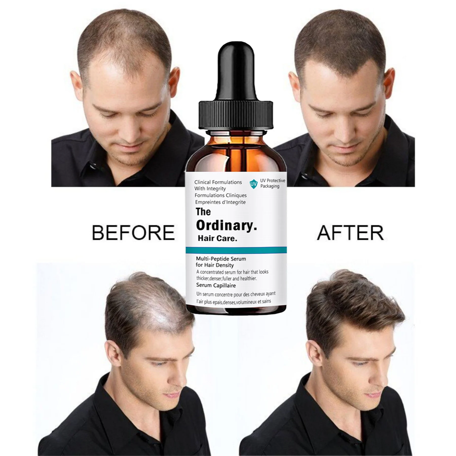 2022-New-Hair-Growth-Essence-Promotes-Hair-Growth-Tool-Ginseng-Oil ...