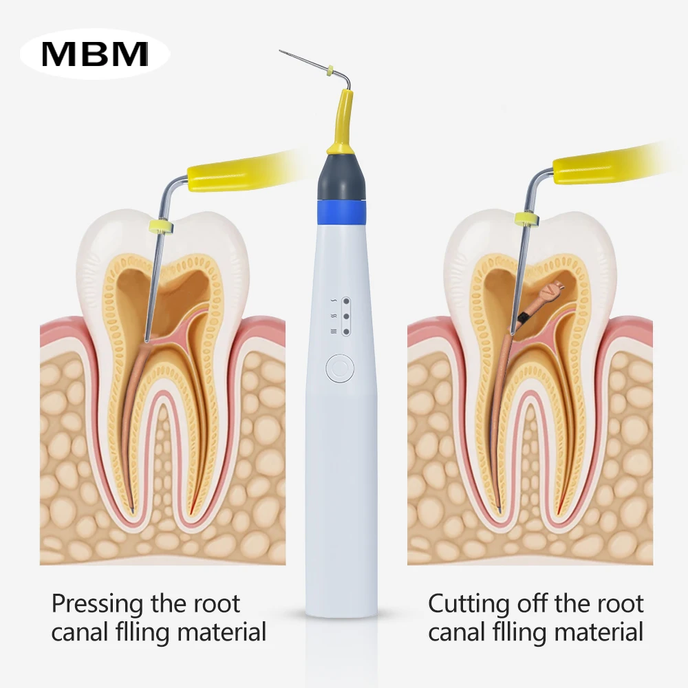 MBM Dental Gutta Percha Heating Pen with 2 Pluggable Tips Wireless Endo ...