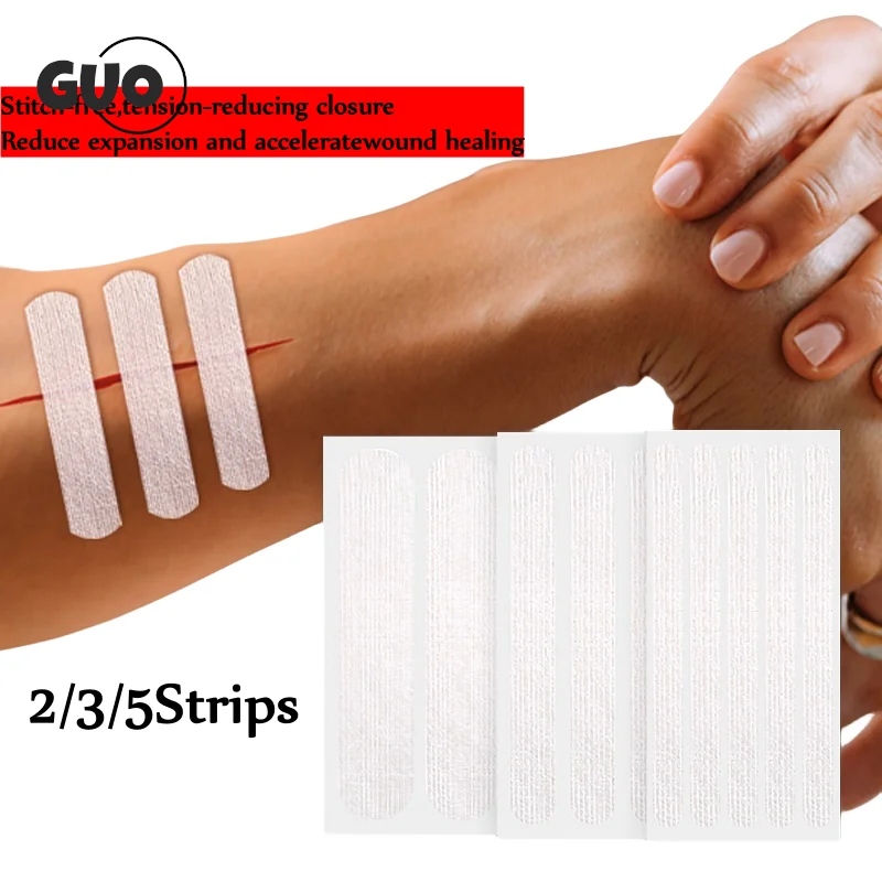 Wound-Skin-Closure-Strips-Postpartum-Wound-Repair-Cosmetic-Surgery ...