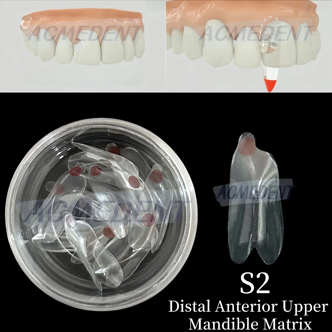 S2-Dental-Transparent-Matrix-Clear-Matrix-BT-Bow-Maxillary-Matrices ...