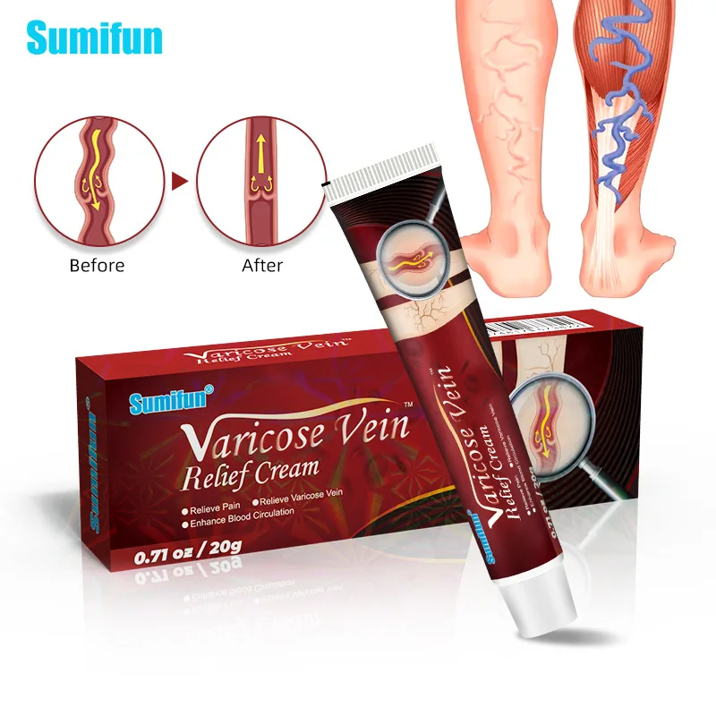 Varizes-Massagem-Creme-Al-vio-Veias-Al-vio-Da-Fadiga-Anti-varizes-Al ...