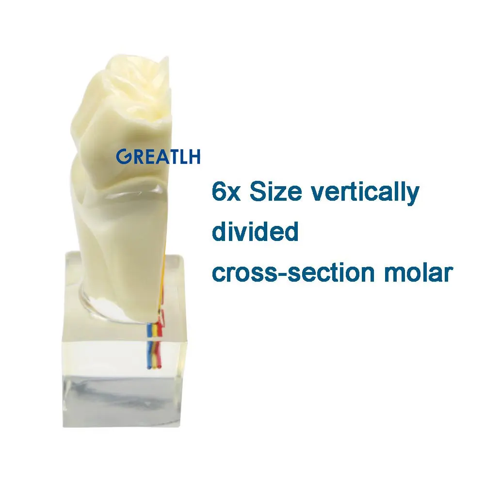 Orthodontic Model 6:1 Teeth Teaching With Clear Base Nerve Anatomical ...