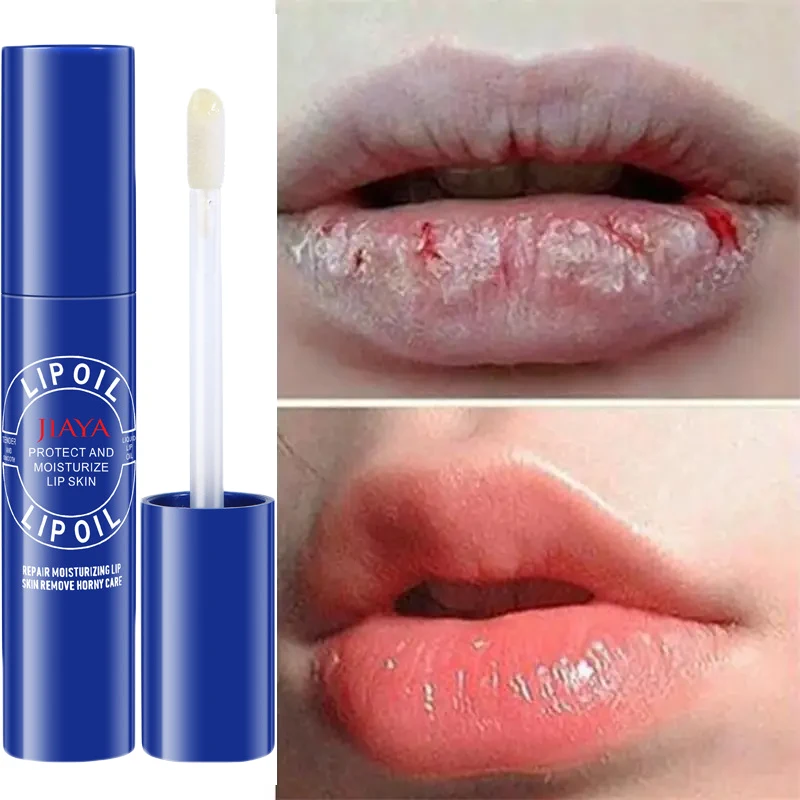 New-Lip-Balm-Remove-Dark-Lightening-Melanin-Mask-Gloss-Oil-Exfoliating ...