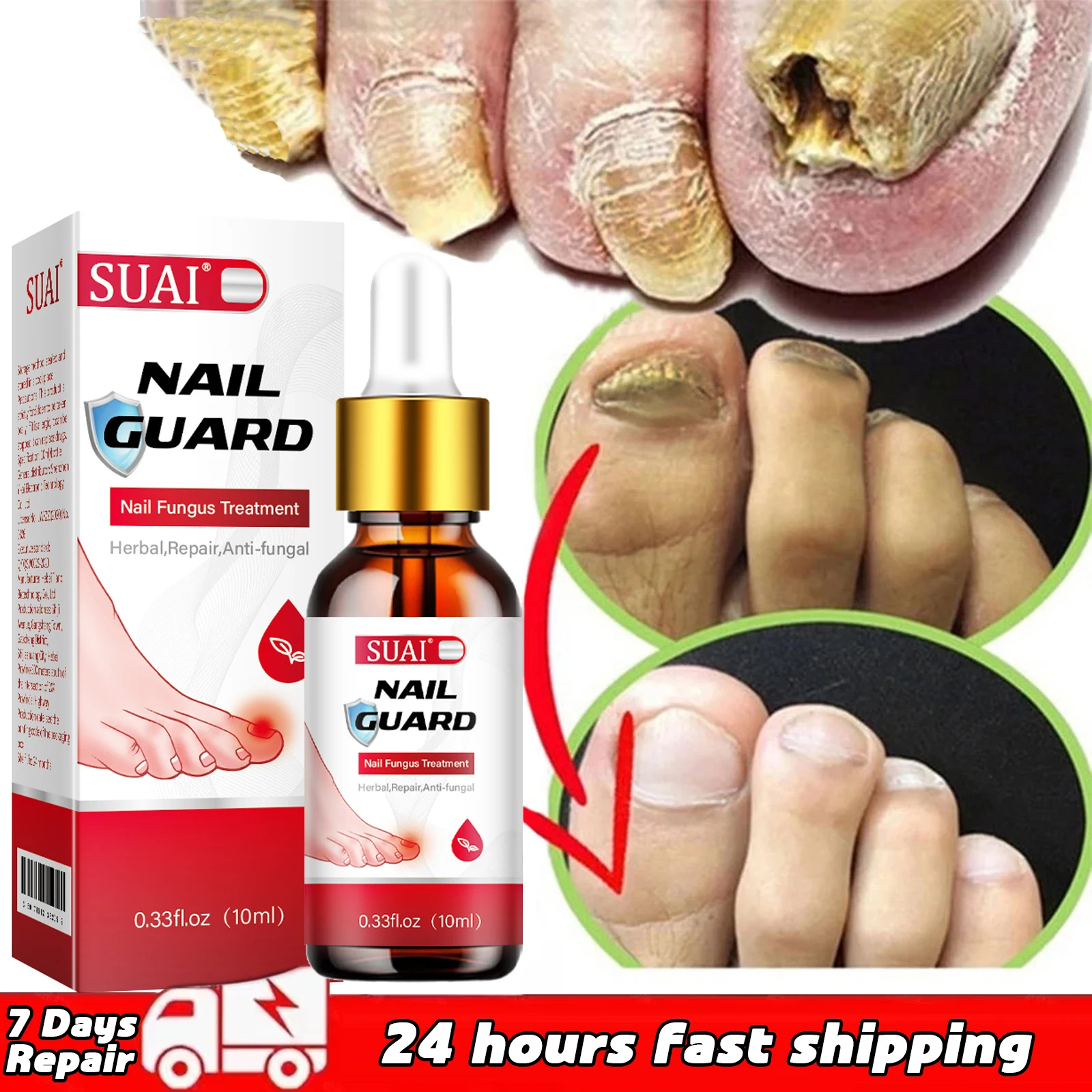SUAI-Nail-Fungus-Treatment-Serum-Toe-Fungal-Repair-Products-Hand-Foot ...