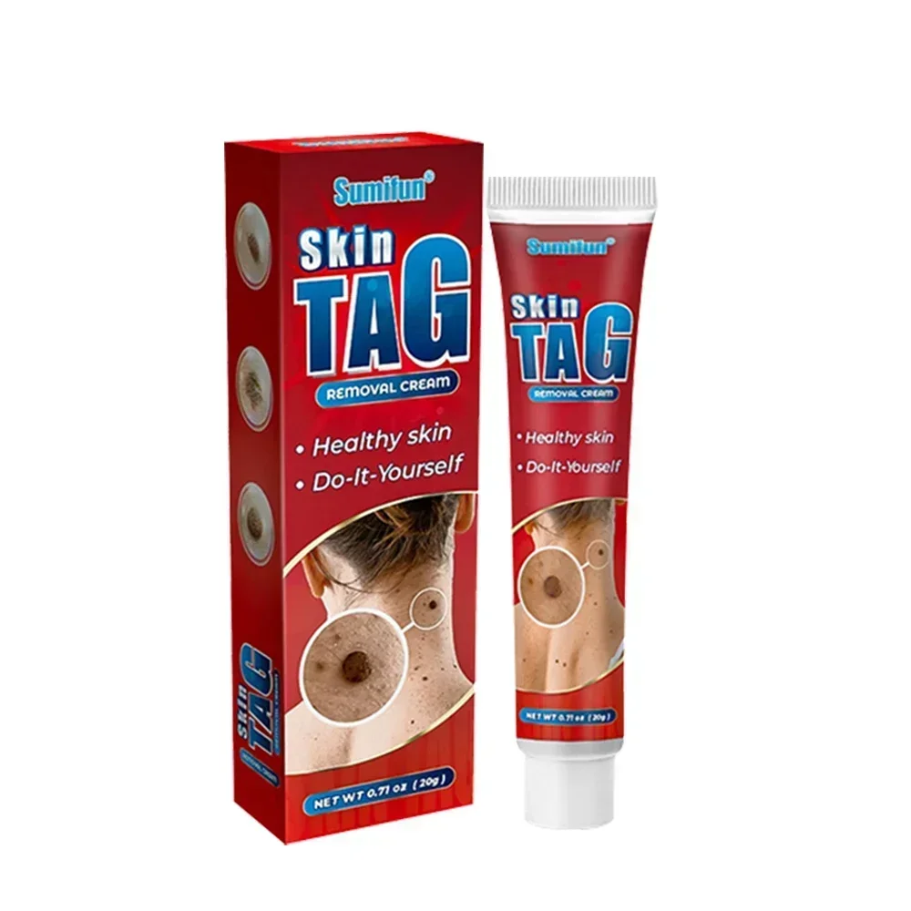 Skin Wart removal Cream | skin tag remover cream price in Pakistan ...