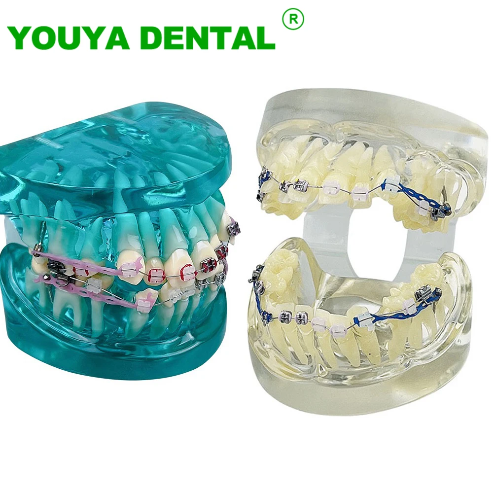 Modelo-de-tratamiento-de-ortodoncia-Typodont-Dental-modelo-de ...