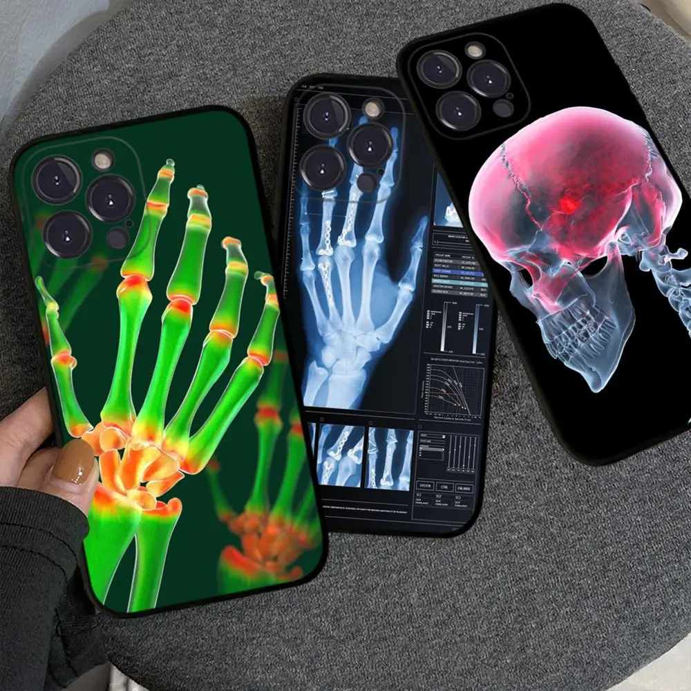Radiological-human-organs-Skeleton-Phone-Case-for-iPhone-15-8-7-6-6S ...