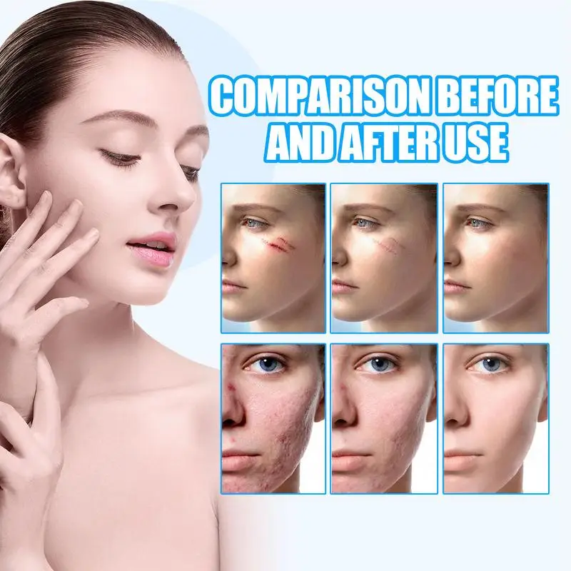 Scar Removing Gel With Effective Function Healthy And Safe Waterproof ...