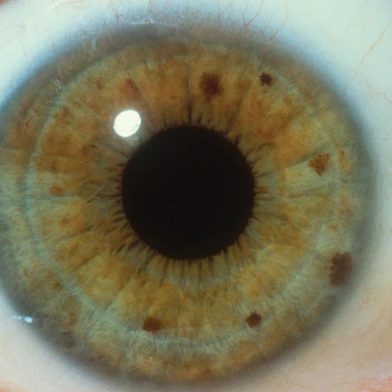 IBOOLO-DE-400-Iris-scanner-analyzer-Eye-Iriscope-Iridology-Iris ...