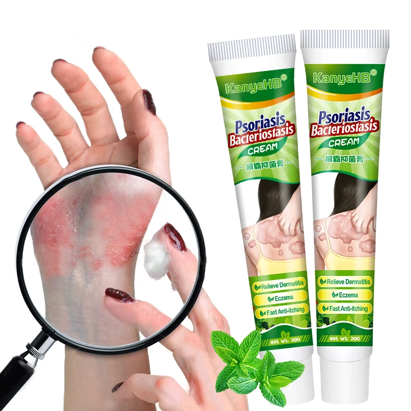 2Pcs-Psoriasis-Treatment-Cream-Foot-Eczema-Tinea-Relieve-Itch-Rash ...