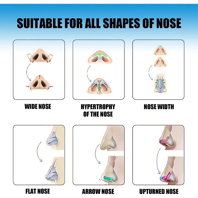 Nose Shapes Chart