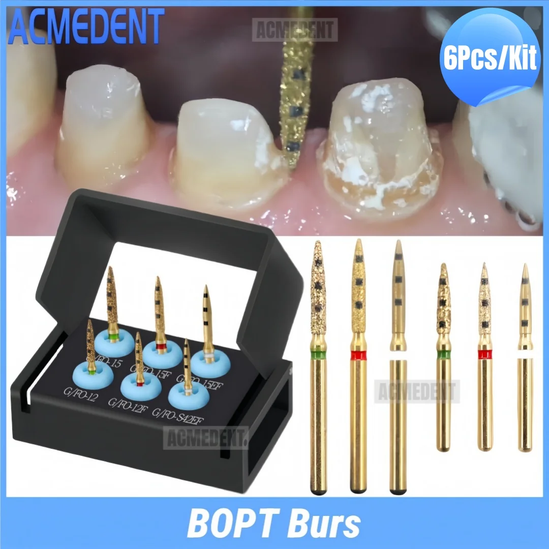 Dental Vertical Diamond FG Burs Biologically Oriented Preperation ...