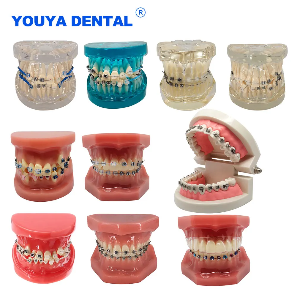 Orthodontic Dental Treatment Teeth Model Teaching Study Gum Tooth ...