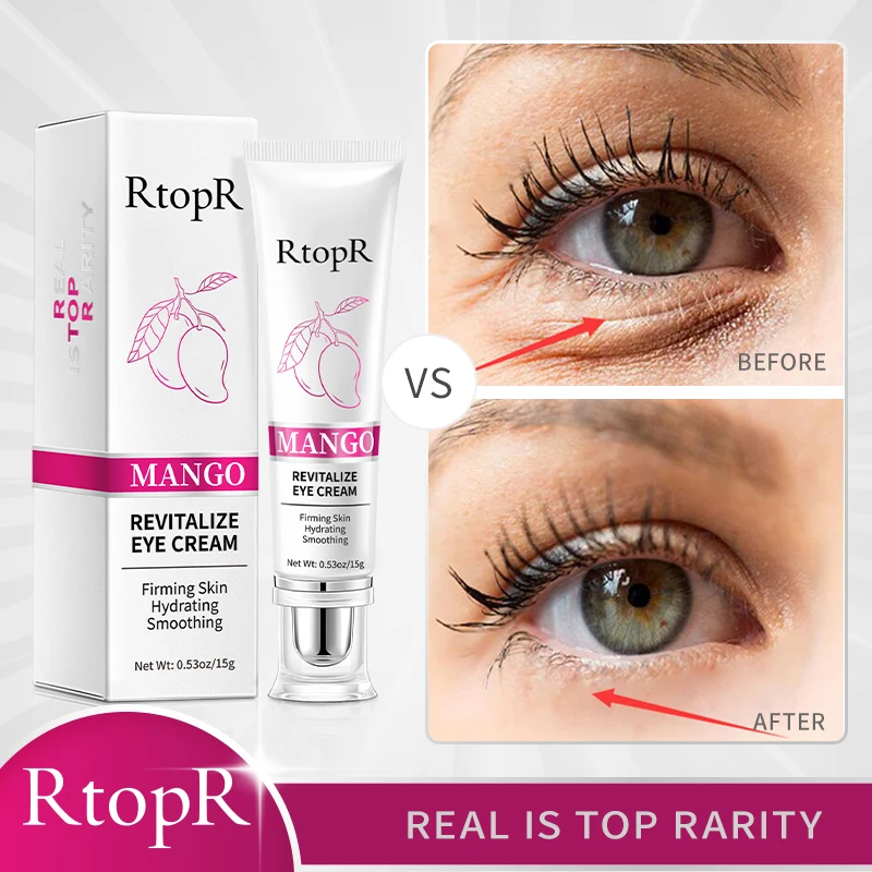 RtopR-Anti-Wrinkle-Eye-Cream-Mango-Moisturizing-Anti-Age-Remove-Dark ...