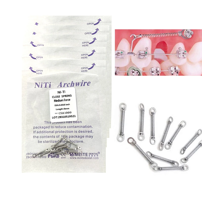 10PCS-Dental-Orthodontic-Single-Anterior-Teeth-Tooth-Torque-Spring ...