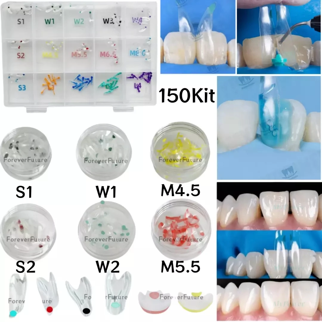 Dental-Clear-Matrix-Anterior-Posterior-Teeth-Matrix-Wedges-Kit-Fit ...
