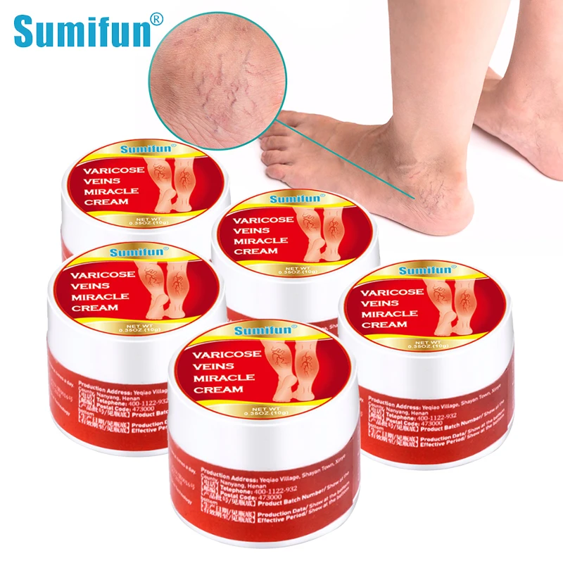 1-3-5Pcs-Sumifun-Varicose-Vein-Removal-Cream-Legs-Blocked-Spider-Veins ...