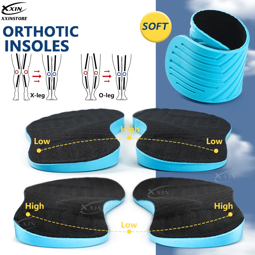 Xxin-Men-Women-X-leg-Correction-Insoles-Orthopedic-Shoe-Pads-O-leg ...