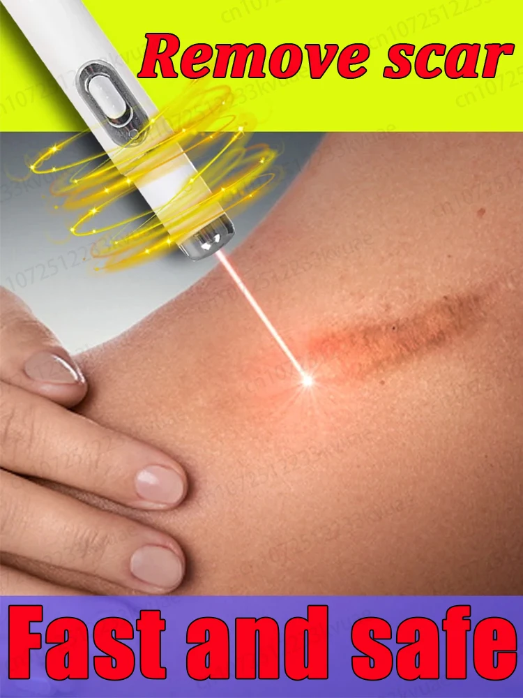 Don't let scars affect your beauty, remove all scars in 7 days ...