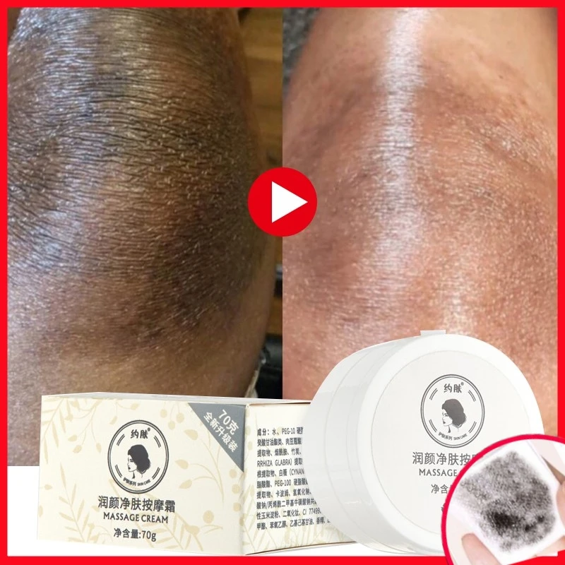 70G-Fast-Whitening-Cream-Dark-Neck-Feet-Underarm-Elbows-Melanin-Remove ...