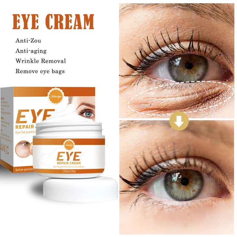 Eye-Care-Anti-Wrinkle-Eye-Cream-Dark-Circles-Eliminate-Eye-Bags-Reduce ...