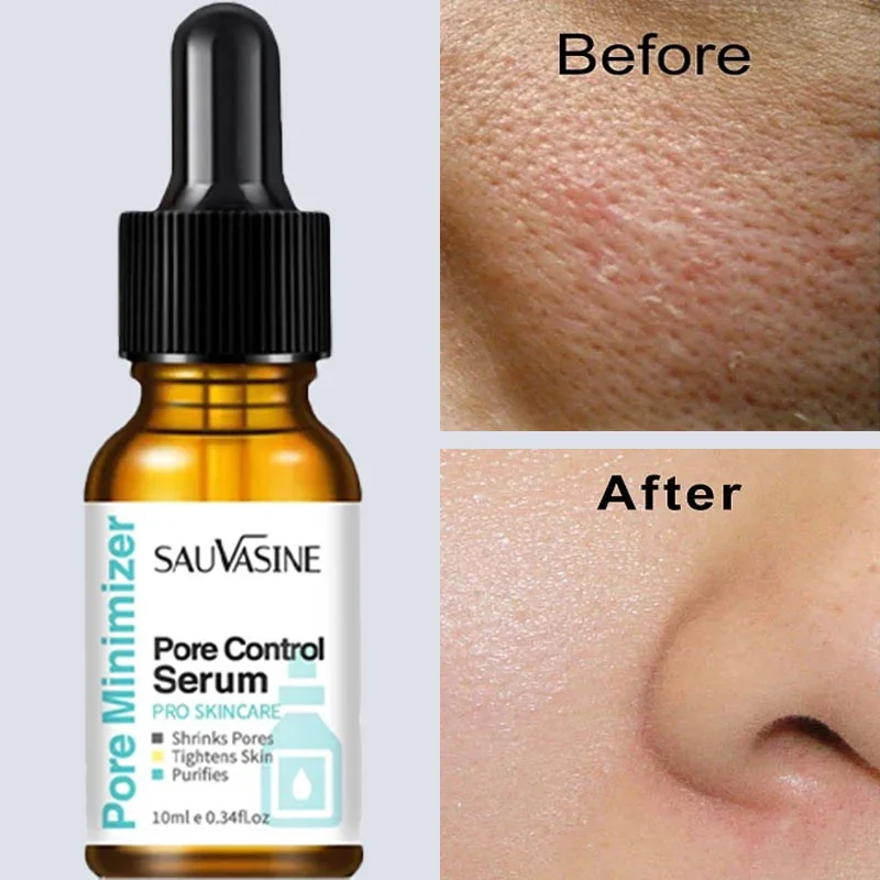 Facial-Pore-Minimising-Serum-Skin-Shrinking-Refining-Serum-Preventing ...