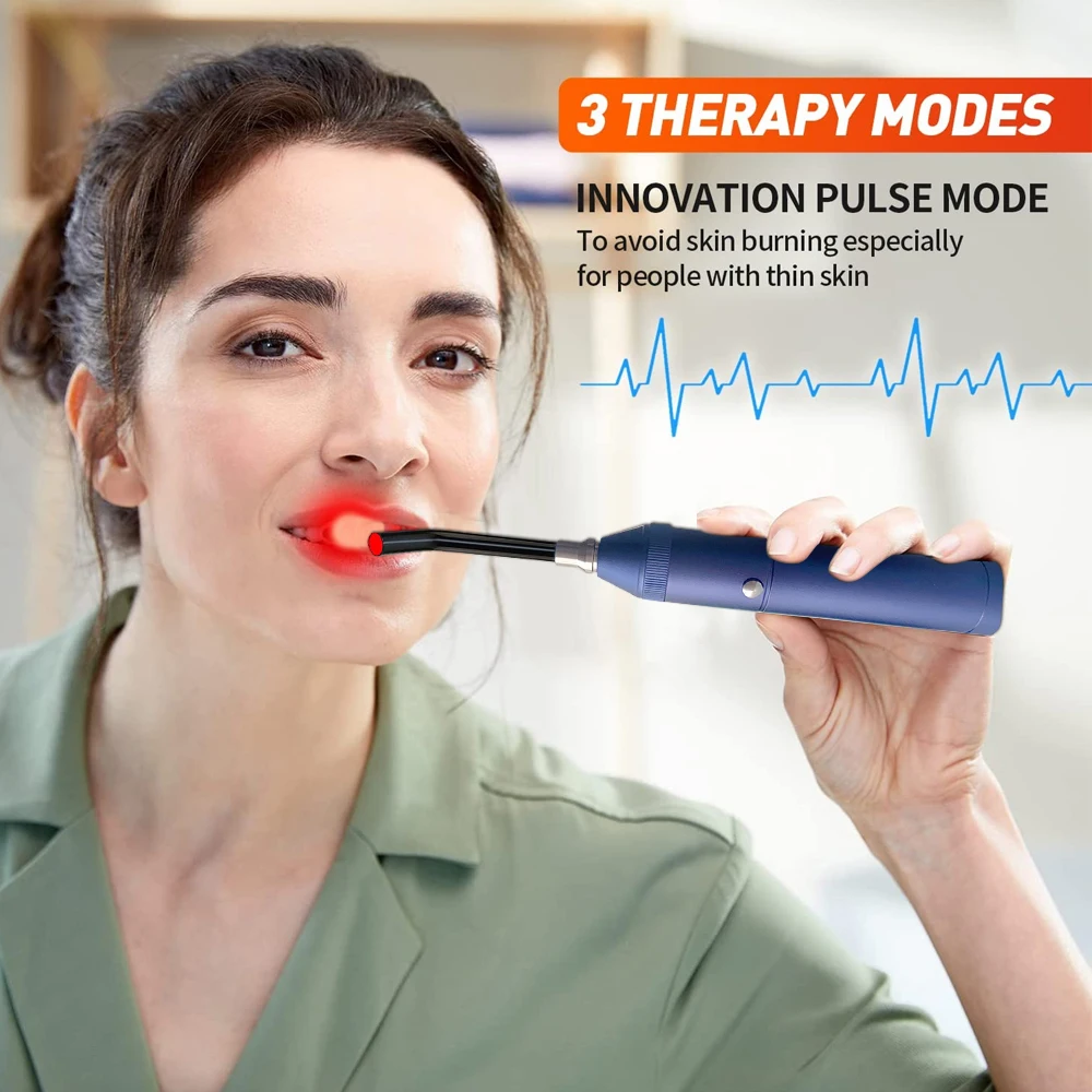 Cold-Sore-Laser-Therapy-Device-for-Canker-Sore-Lip-Herpes-Oral-Ulcers ...