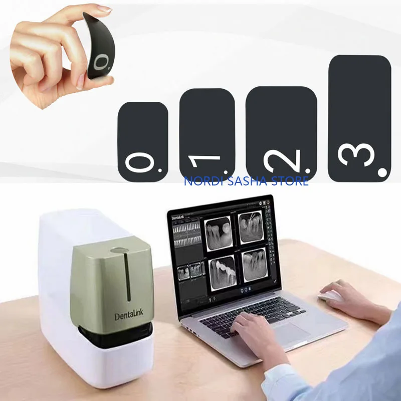 Dental X-Ray Digital Scanner, Sensor de Radiovisor, RX Match Plate ...