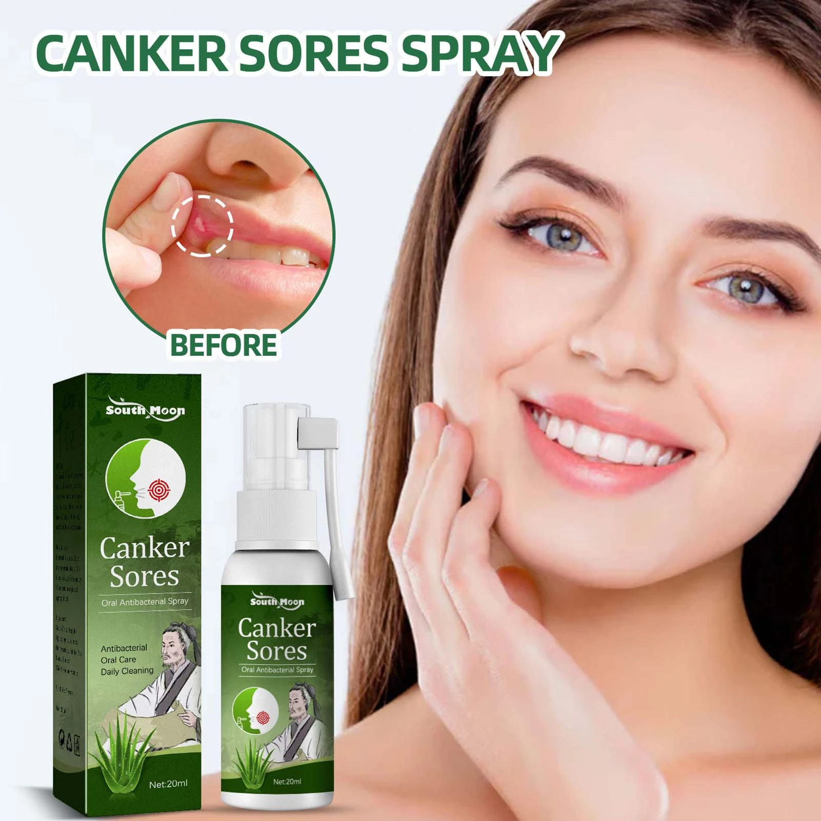 Ulcers In Mouth