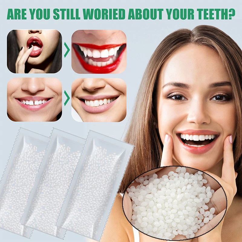 Temporary-Tooth-Repair-Kit-Teeth-And-Gaps-FalseTeeth-Solid-Glue-Tooth-Repair-Filling-Glue-Resin ...